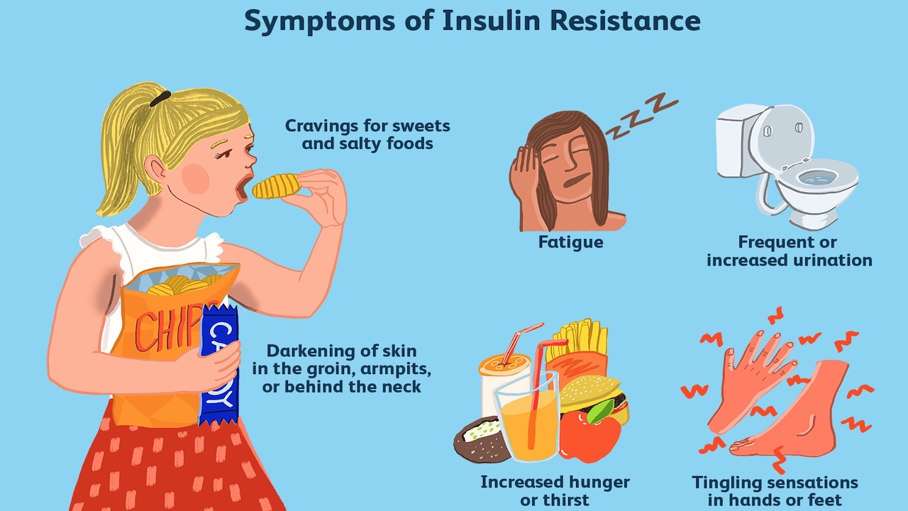 Insulin resistance: The link between cancer and diabetes - SDN