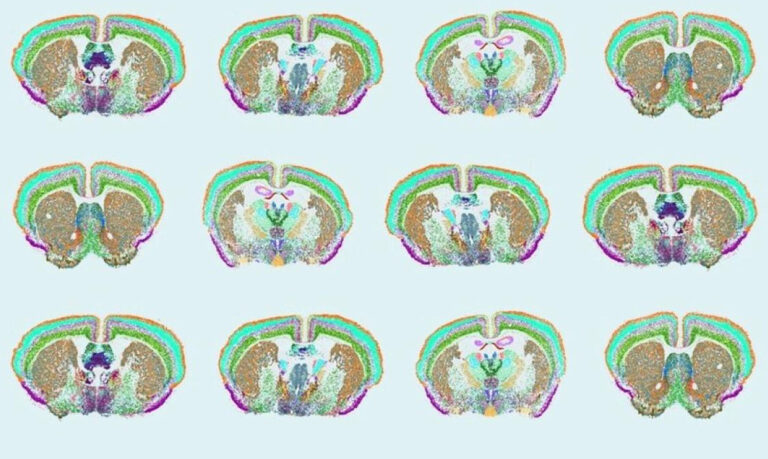 Complete cell map of mammalian brain unveiled! - ShiftDelete.Net Global