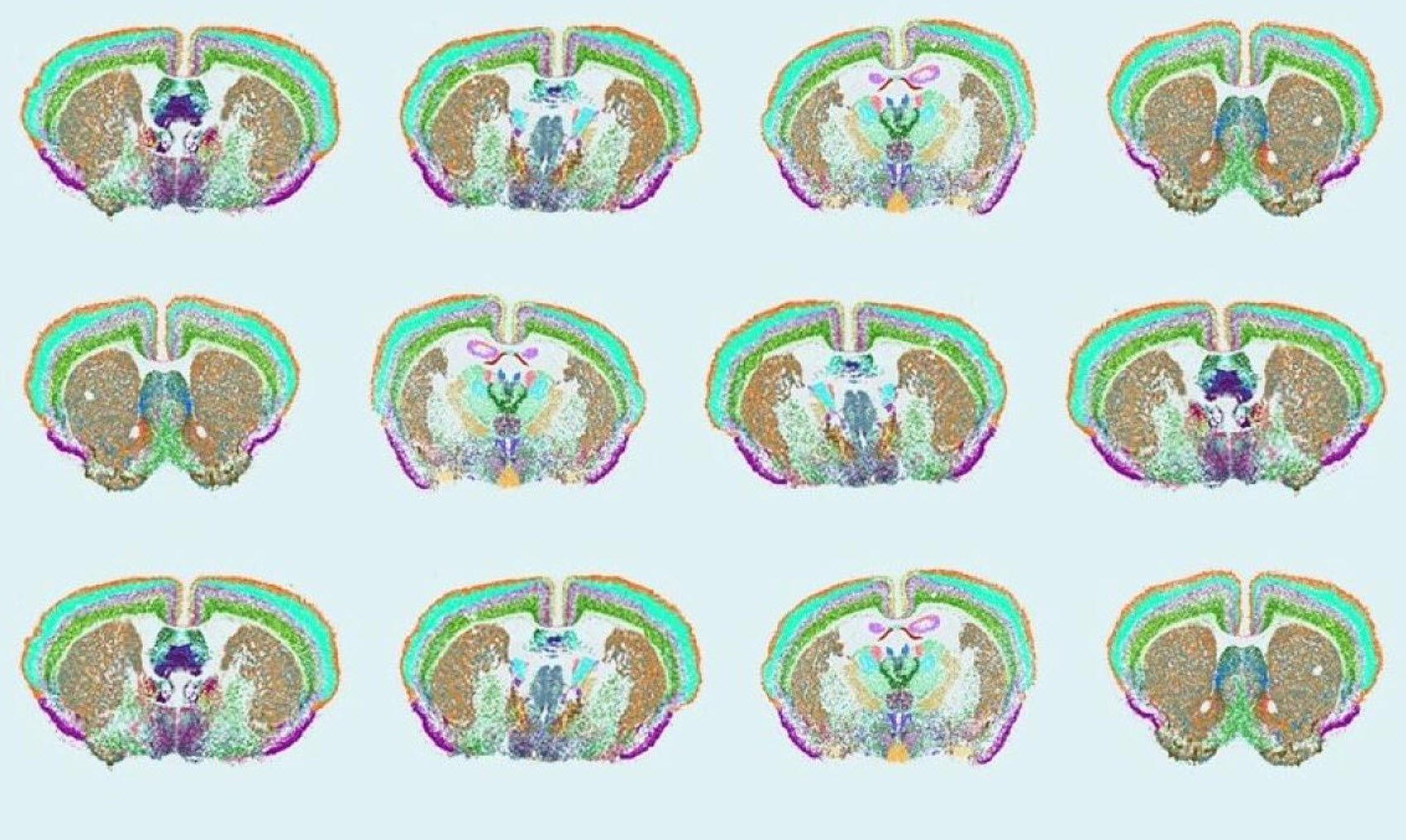 Complete cell map of mammalian brain unveiled! - ShiftDelete.Net Global