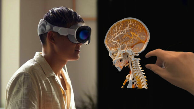 A world first: Surgeons perform surgery with Vision Pro! - ShiftDelete ...