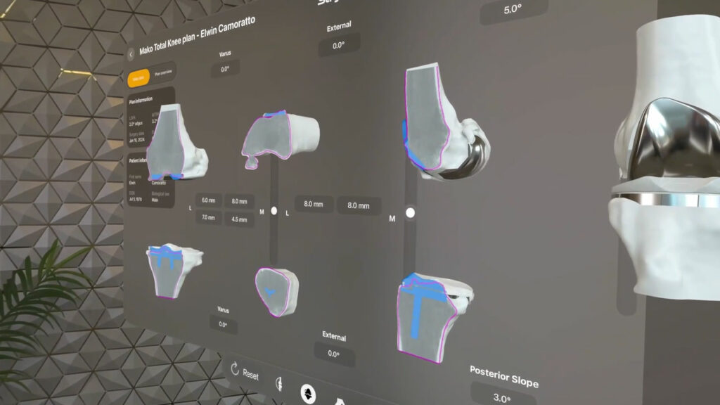 A world first: Surgeons perform surgery with Vision Pro! - ShiftDelete ...